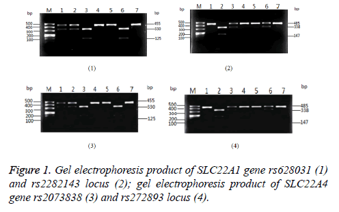 Retracted: Relationship between SLC22A1 and SLC22A4 gene polymorphisms ...